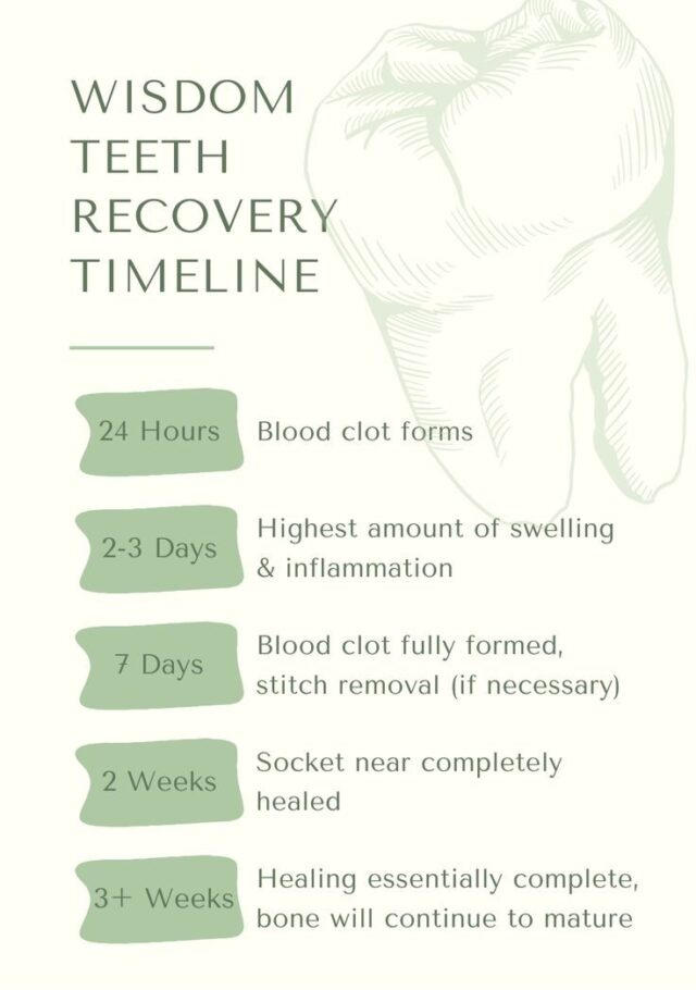 10 myths debunked about wisdom tooth removal